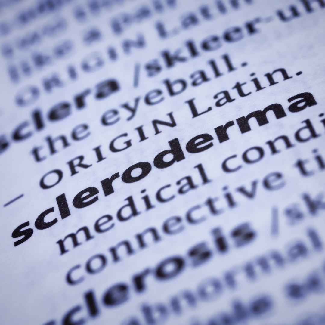 JUNE IS NATIONAL SCLERODERMA AWARENESS MONTH - Rural Physicians Group